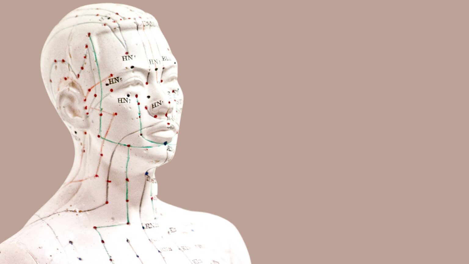 Acupuncture for Headaches: Natural Relief – Shen Medicine